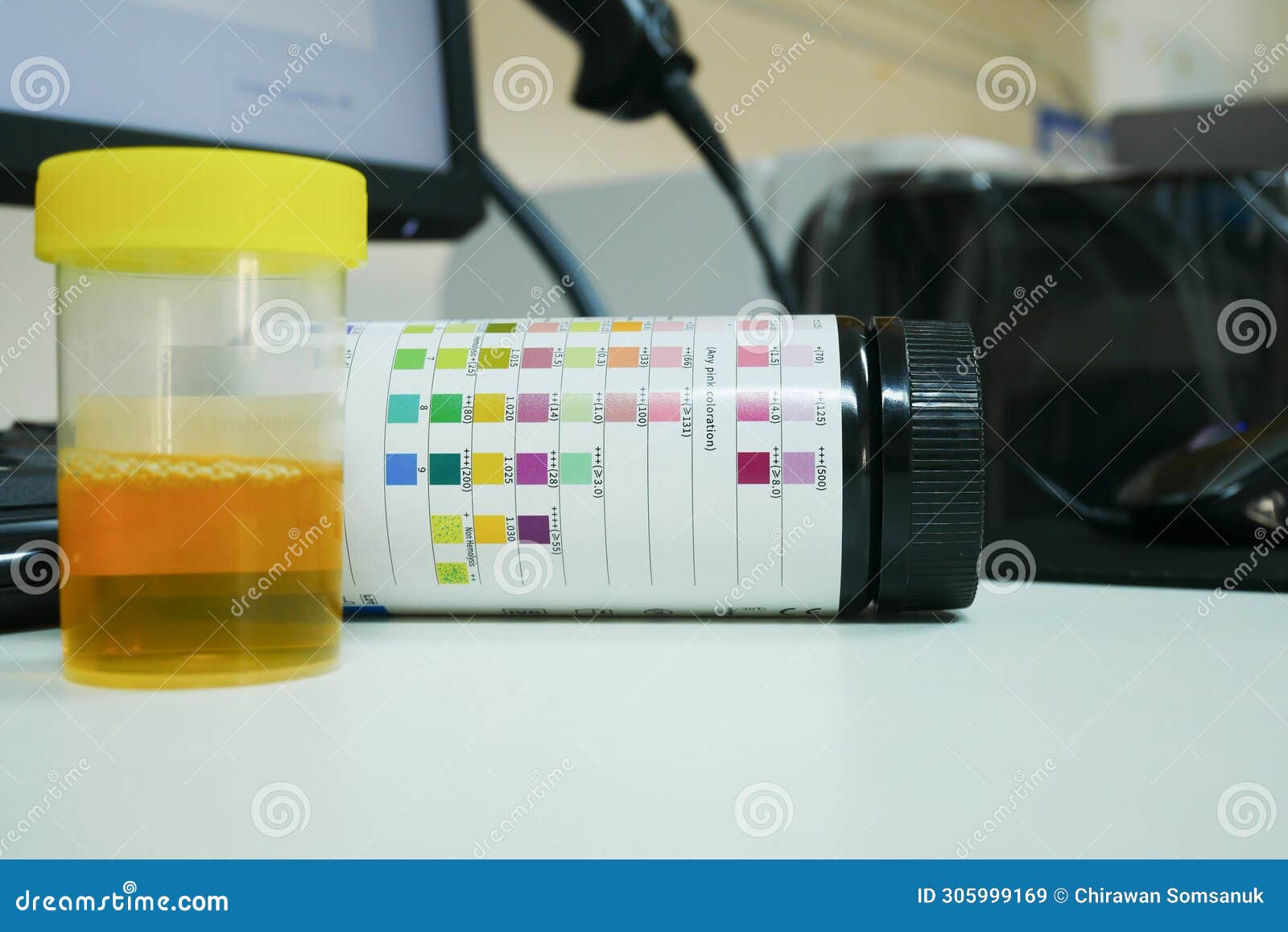 Urine Analysis in Laboratory Stock Image - Image of disease, laboratory ...
