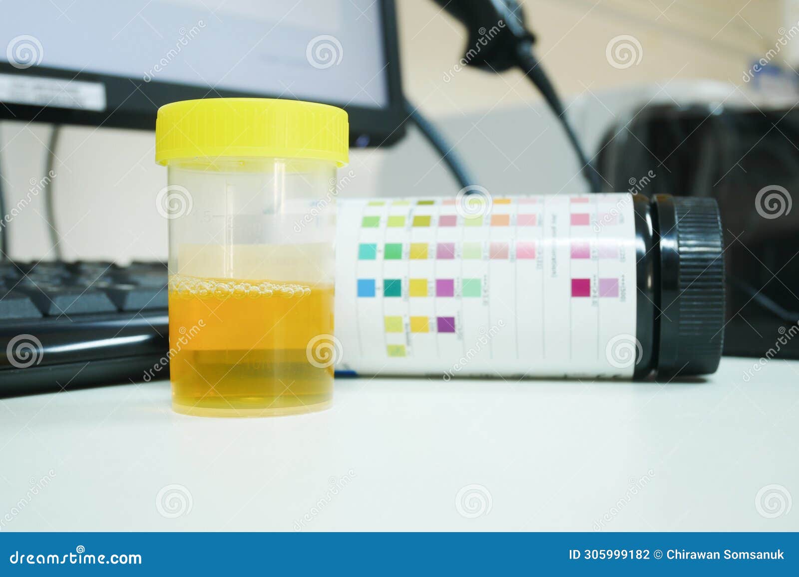Urine Analysis in Laboratory Stock Photo - Image of medicine, diagnosis ...