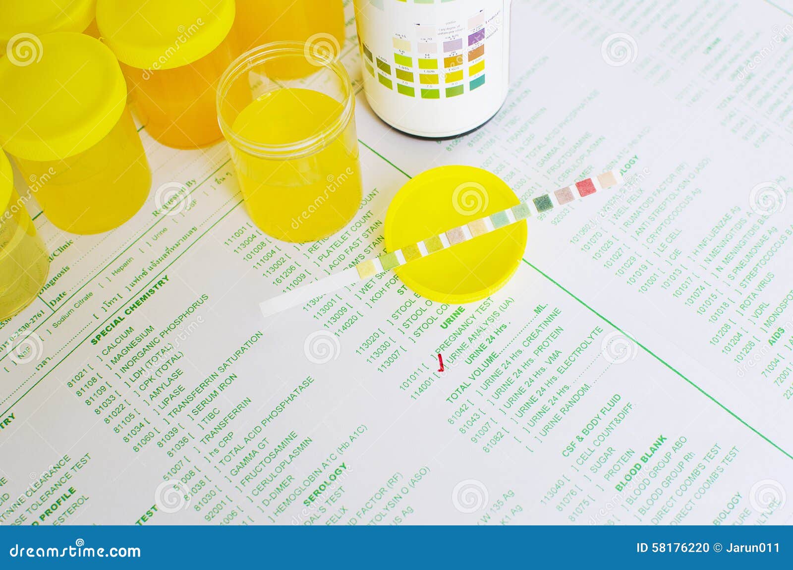 Urine analysis stock photo. Image of laboratory, analyzing - 58176220
