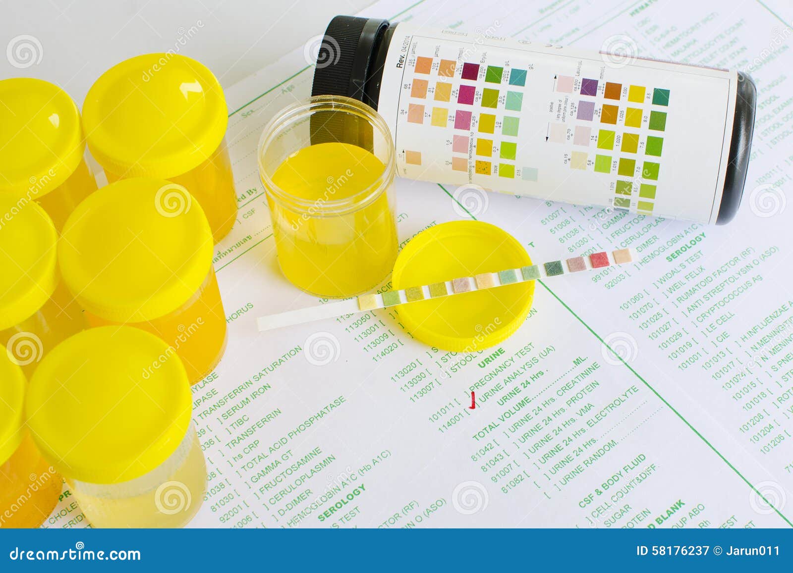 Urine analysis stock image. Image of chemistry, scientific - 58176237