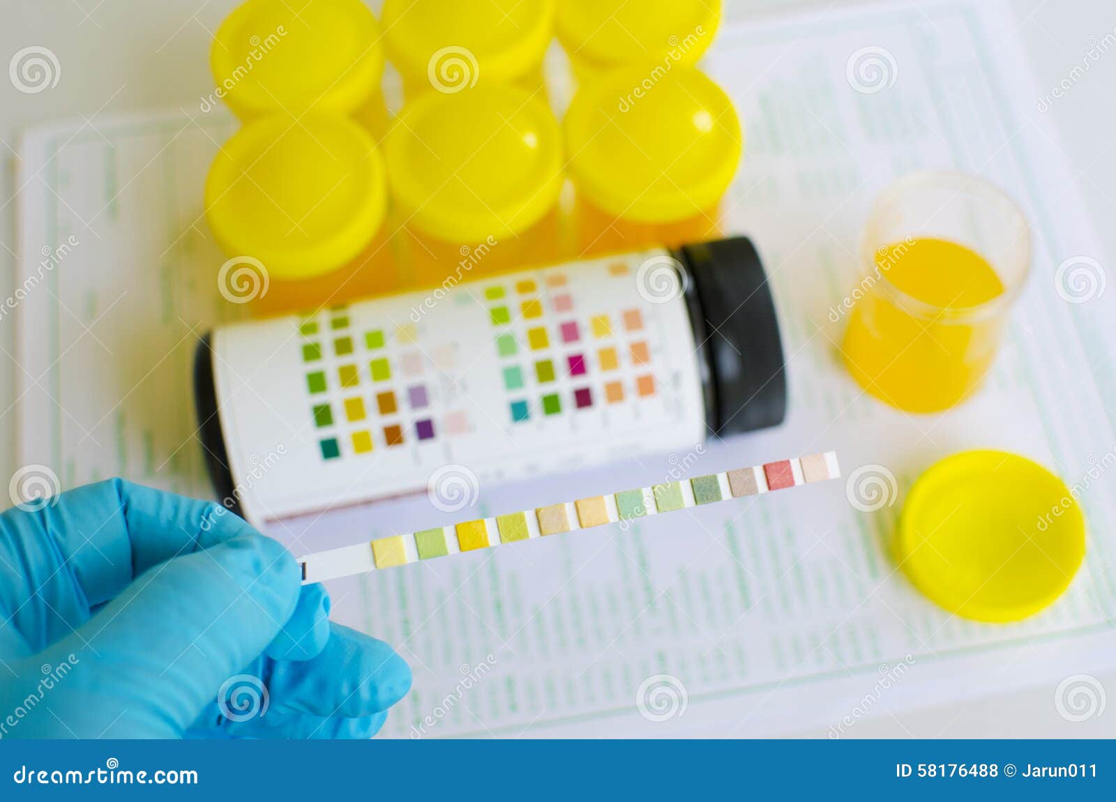 Urine analysis stock photo. Image of checkup, laboratory - 58176488