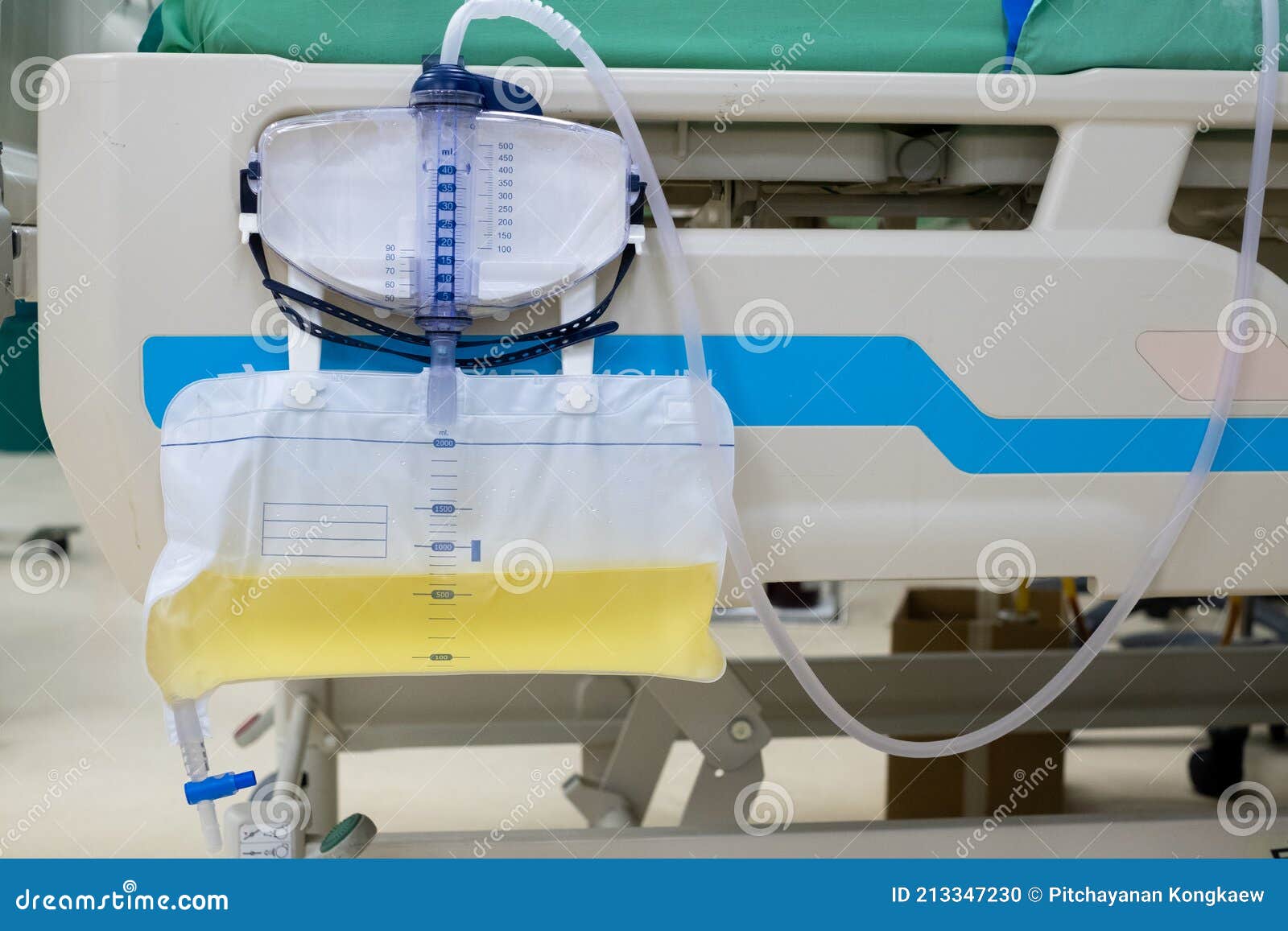 Urine Bladder Suprapubic Puncture Biopsy Or Cystoscopy Procedure ... Urine Bladder Suprapubic Puncture Biopsy Or Cystoscopy Procedure ...