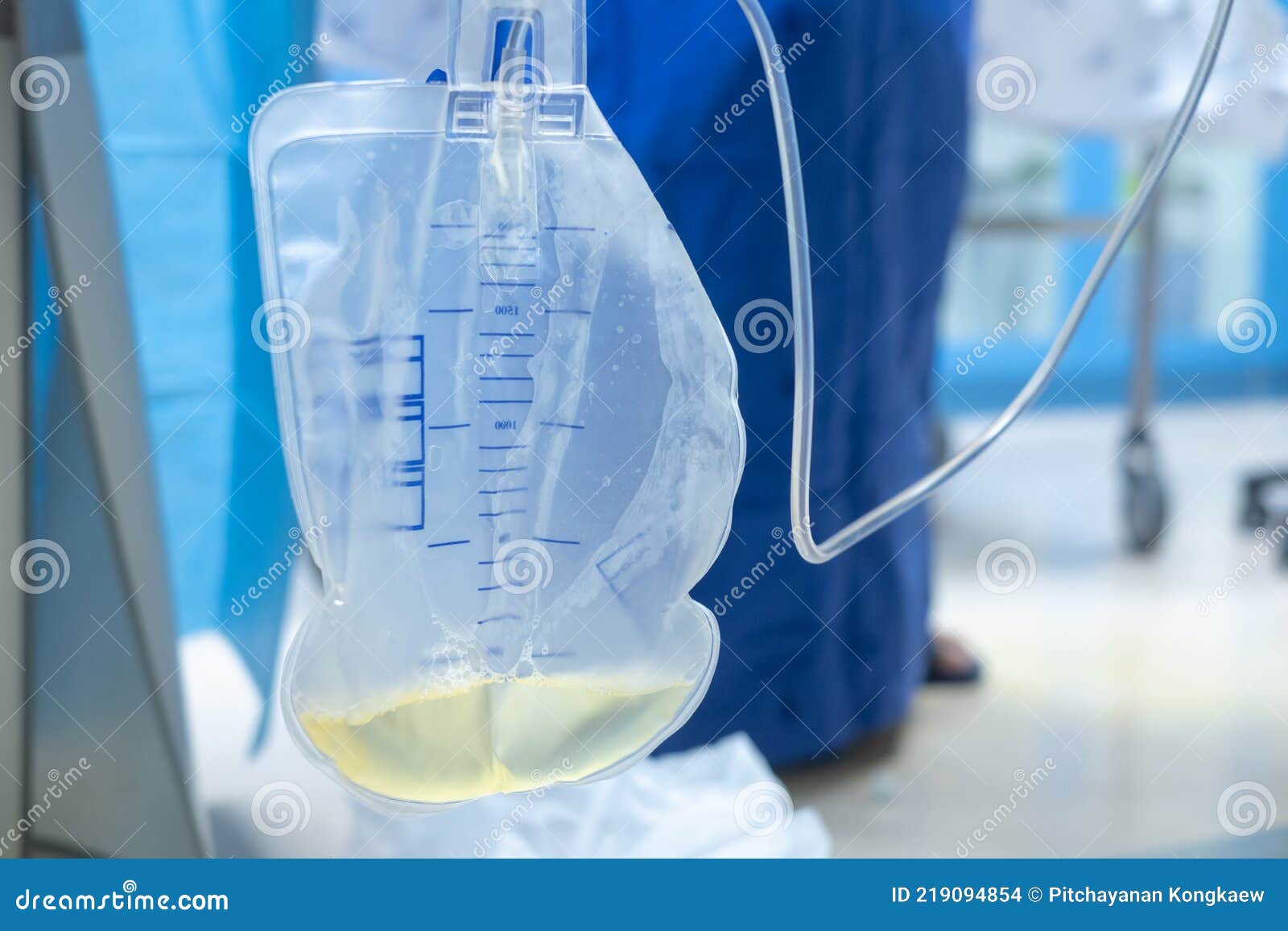 Urine Bladder Suprapubic Puncture Biopsy Or Cystoscopy Procedure ... Urine Bladder Suprapubic Puncture Biopsy Or Cystoscopy Procedure ...