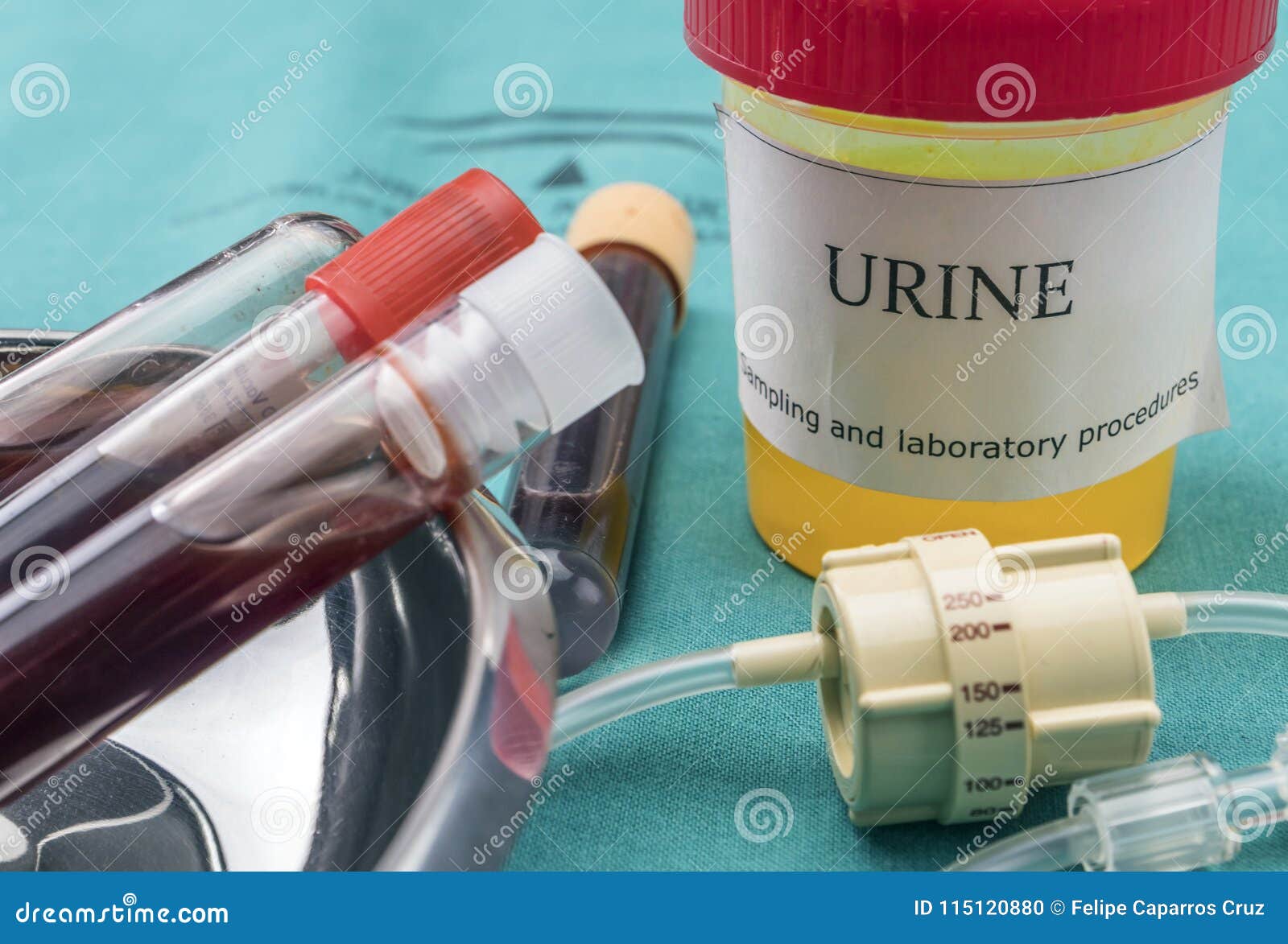 Urine and Blood Samples at a Hospital Table Stock Photo - Image of ...