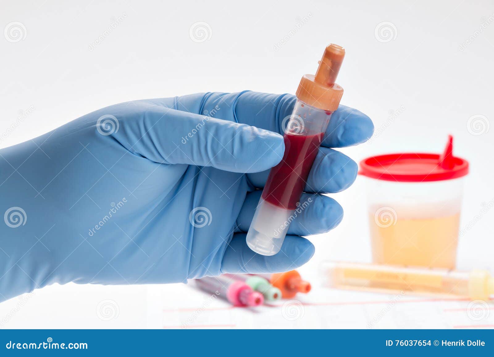 Urine and Blood Test (complete Blood Count) Stock Photo - Image of ...