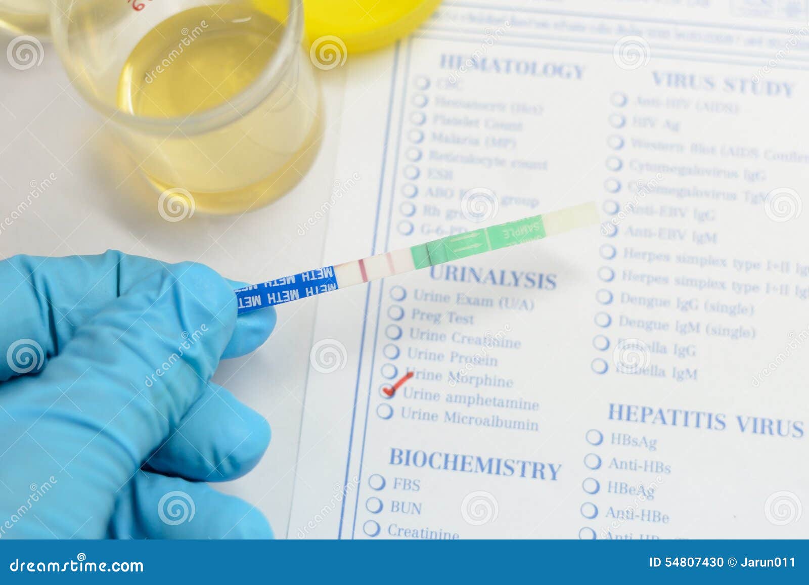 Urine Methamphetamine Testing Stock Photo - Image of scientific ...