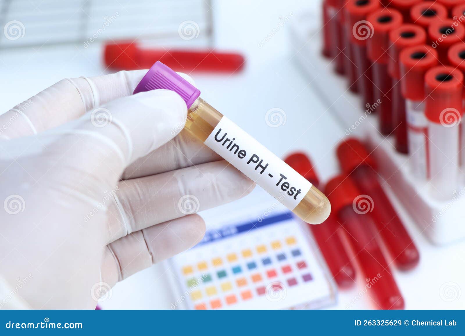 Urine PH Test To Look for Abnormalities from Urine, Urine Sample To ...