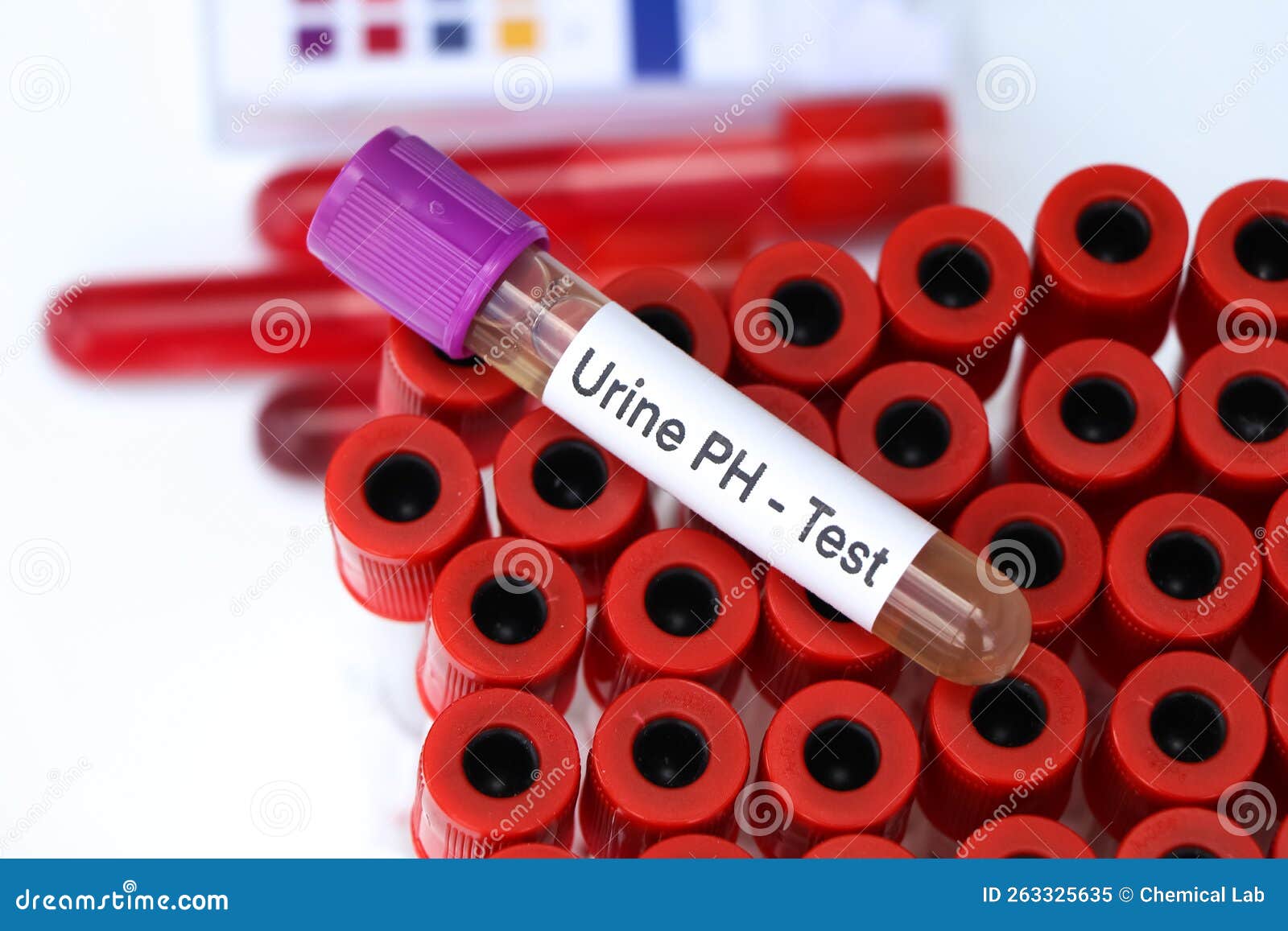Urine PH Test To Look for Abnormalities from Urine, Urine Sample To ...