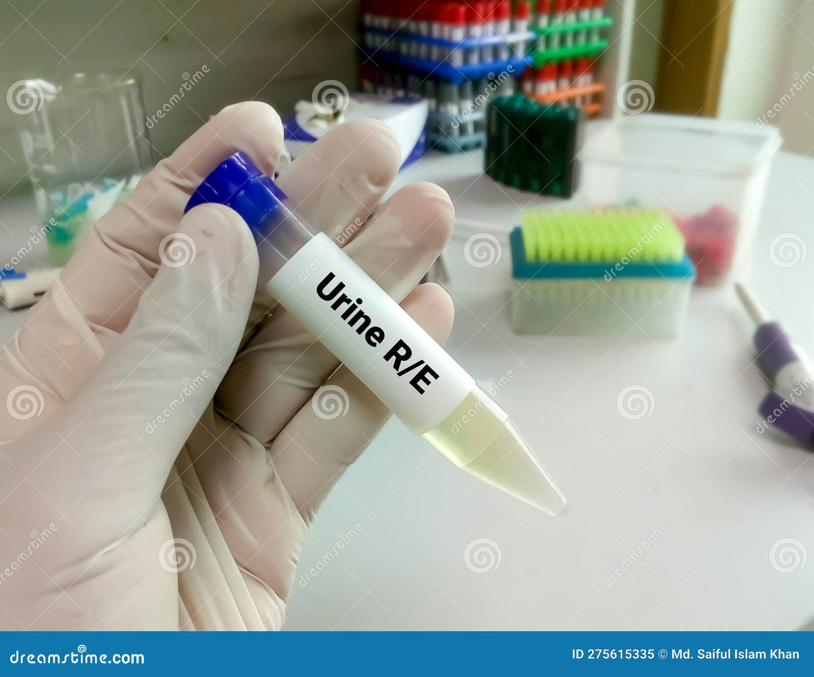 Urine routine examination stock image. Image of cell - 275615335