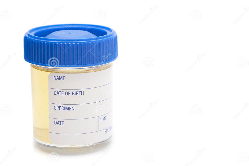 Urine sample stock photo. Image of pathology, urine, laboratory - 18917228