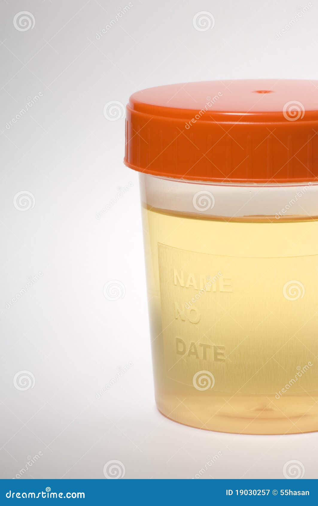 Urine Sample stock image. Image of laboratory, medical - 19030257