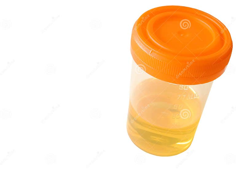 Urine sample stock photo. Image of examine, heal, glass - 496756