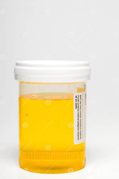 Urine Sample stock image. Image of healthy, test, healthcare - 5148015