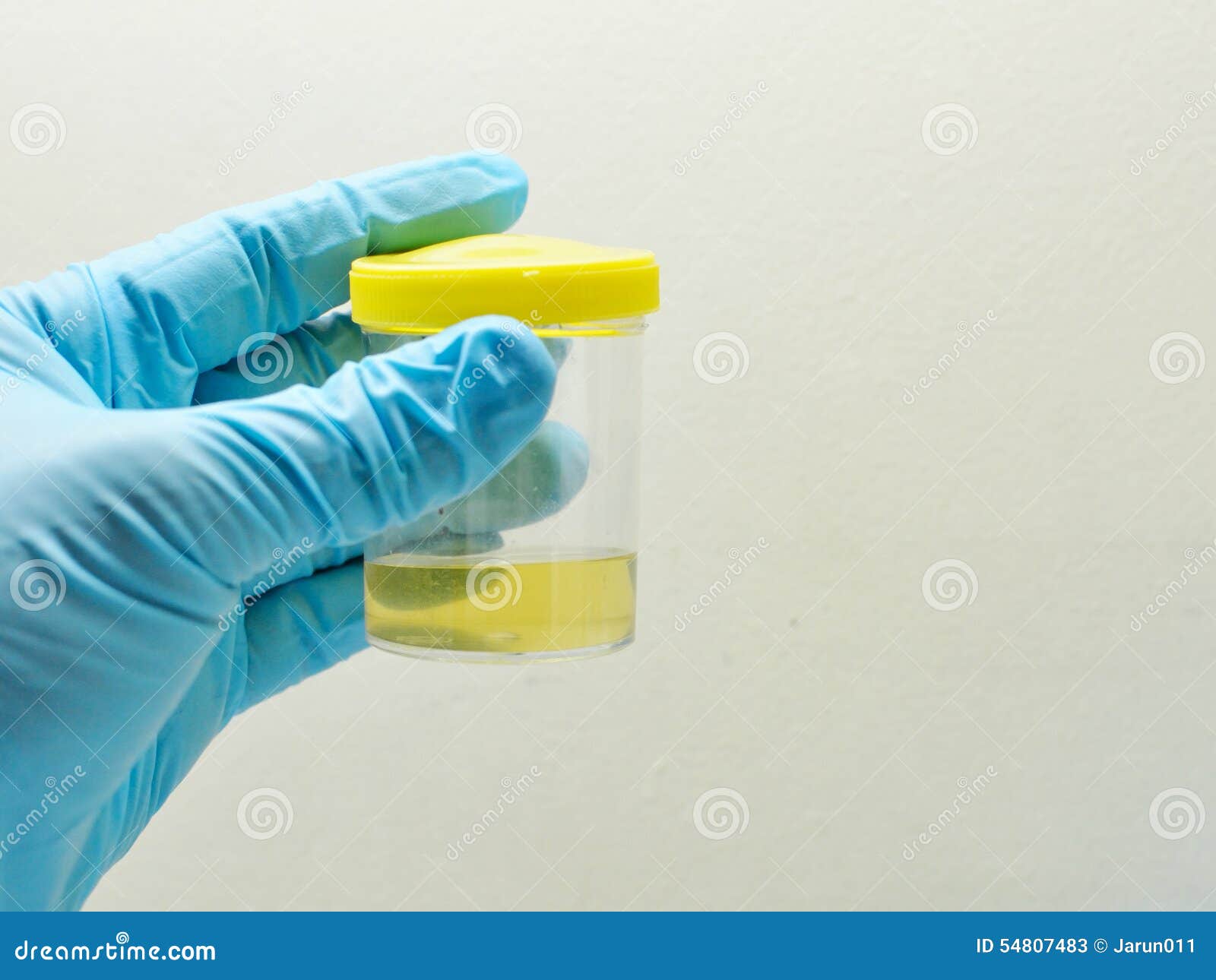 Urine sample stock image. Image of analyzing, science - 54807483