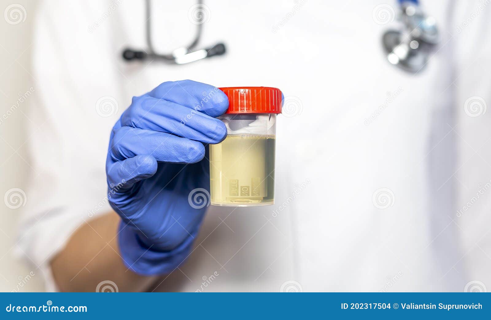 Urine Sample for Exam or Analysis in Bottle or Jar or Container in ...