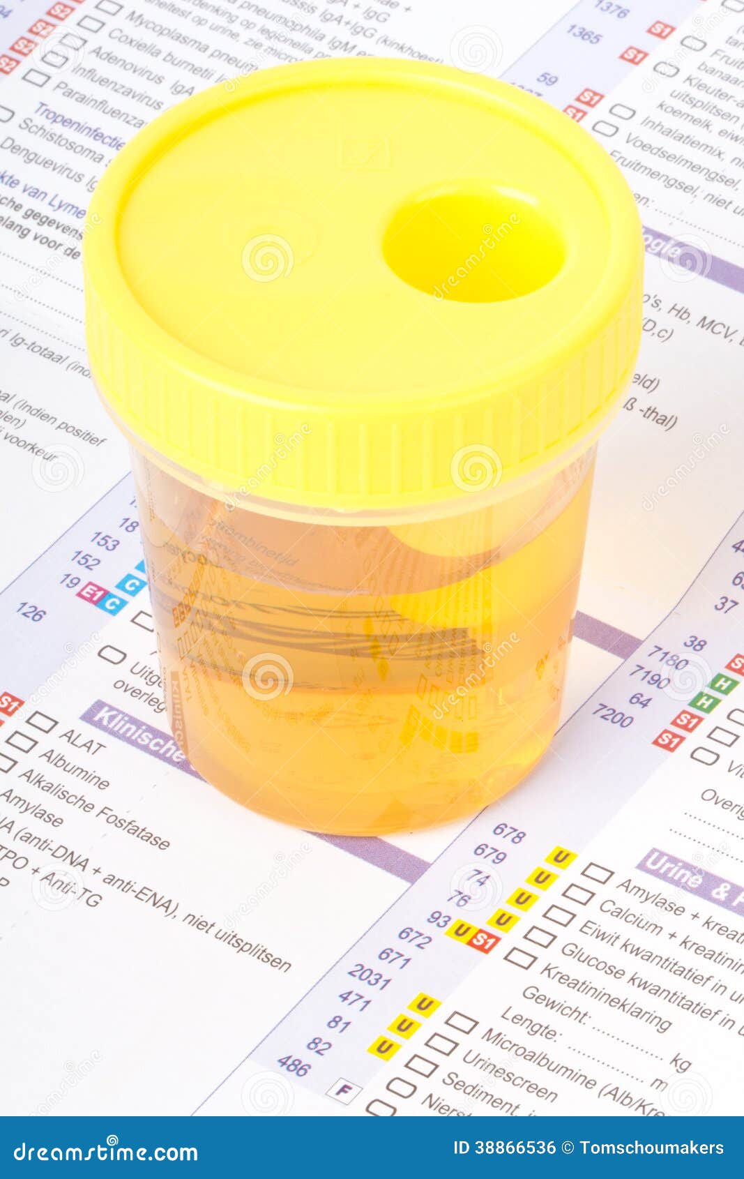 Urine sample on a lab form stock photo. Image of check - 38866536