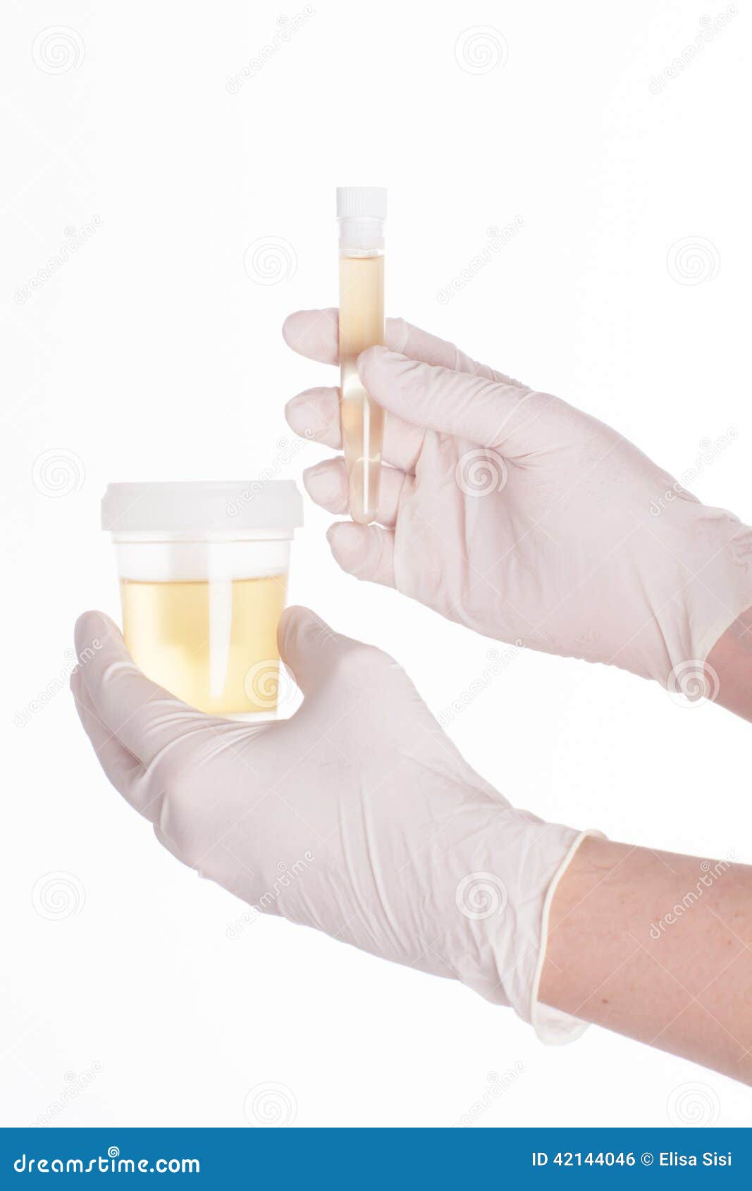 Urine sample stock photo. Image of doctor, research, laboratory - 42144046