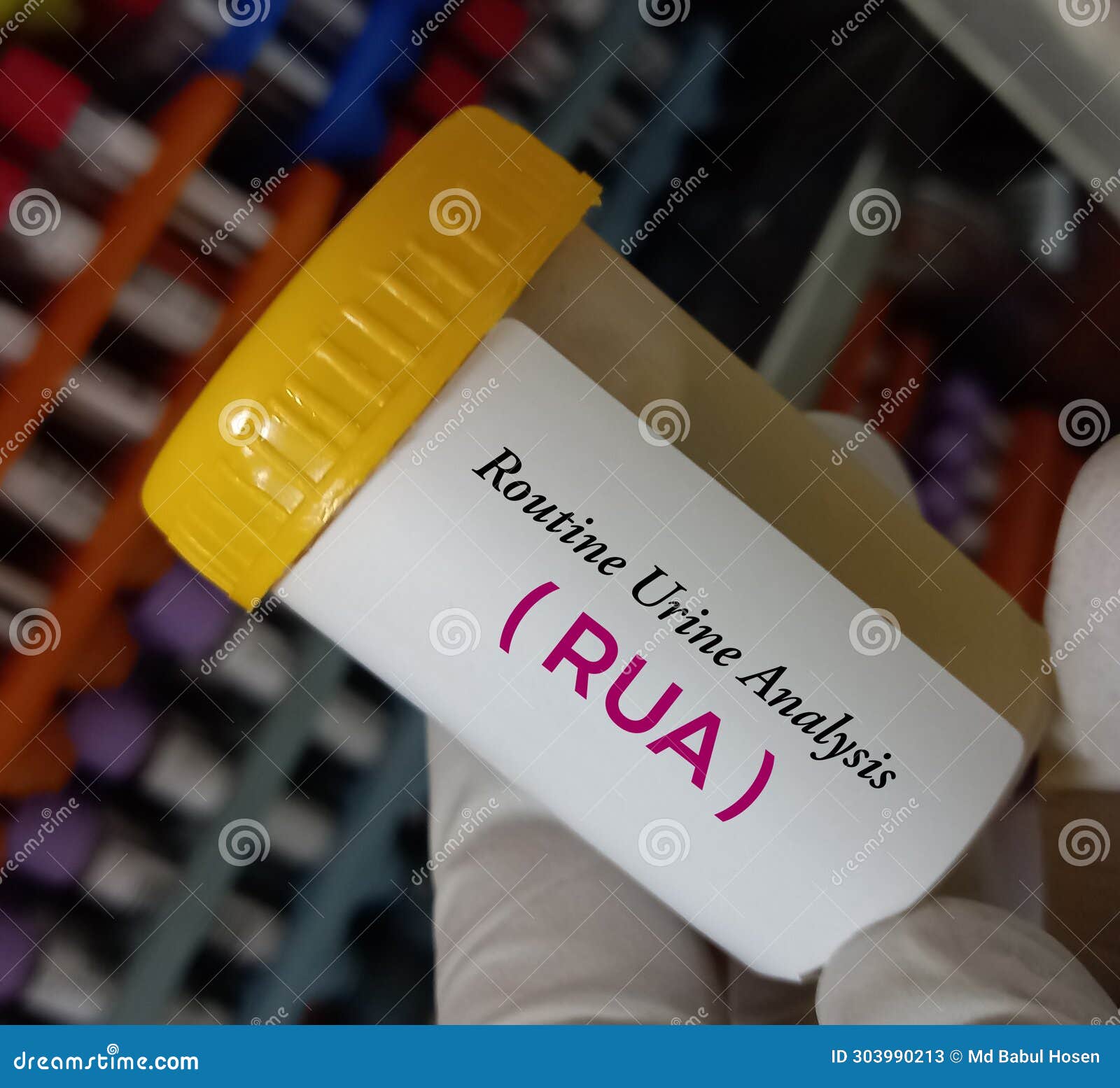 Urine Sample for RUA (Routine Urine Analysis) Test. Urine RE Test Stock ...