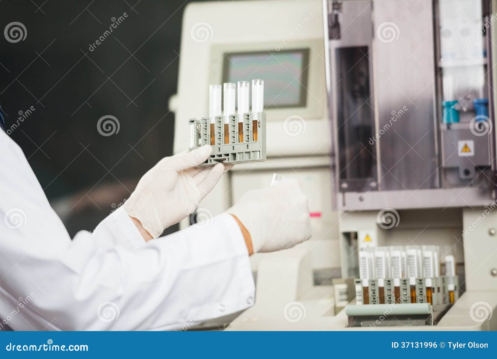 Urine Sample stock photo. Image of facility, laboratory - 37131996