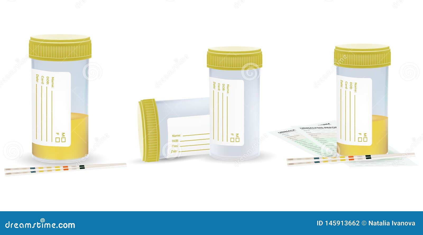 Urine Sample Set, Full and Empty Containers. Vector Illustration Stock ...