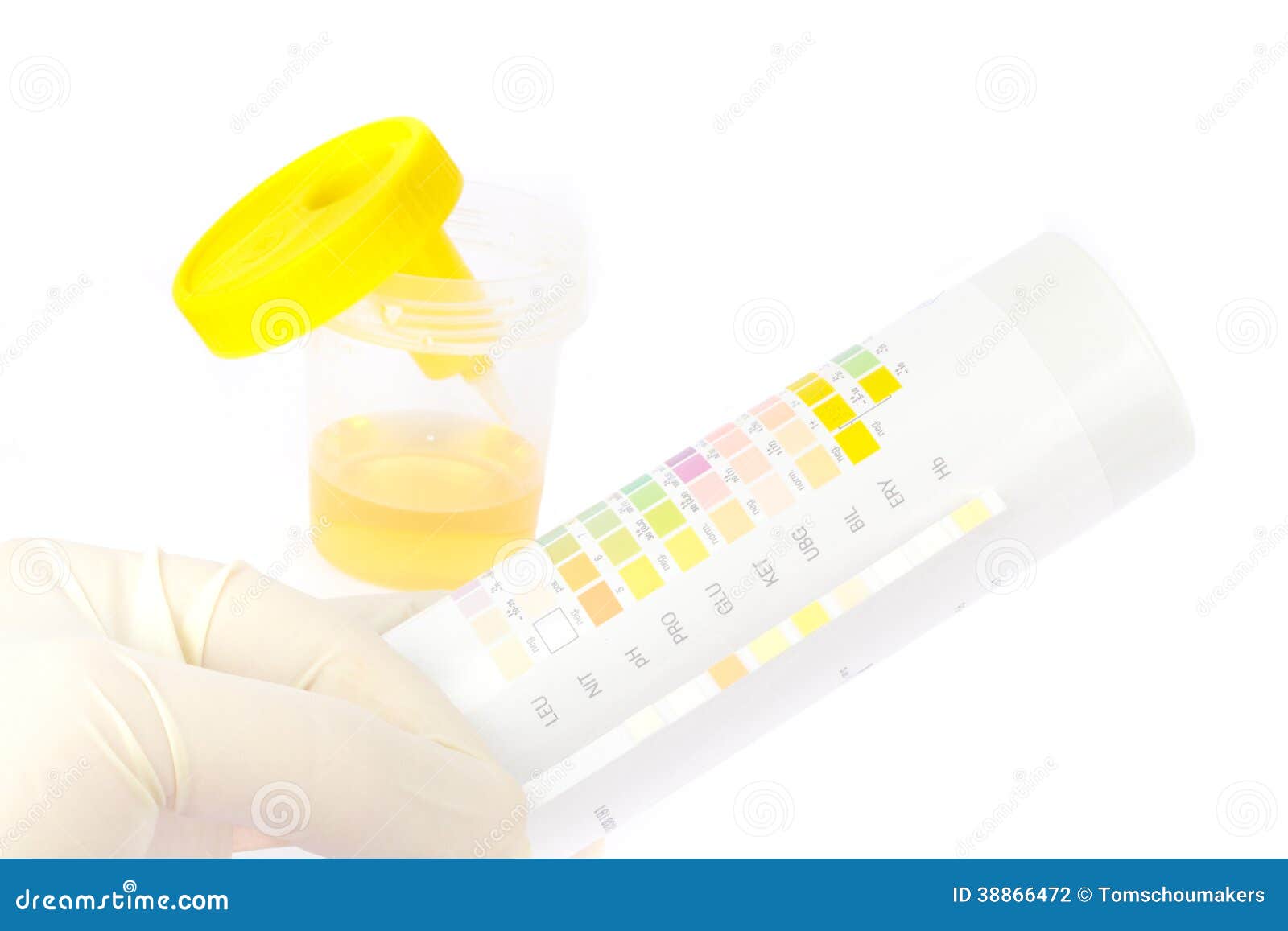 Urine Sample with Test Strips Stock Photo - Image of container ...