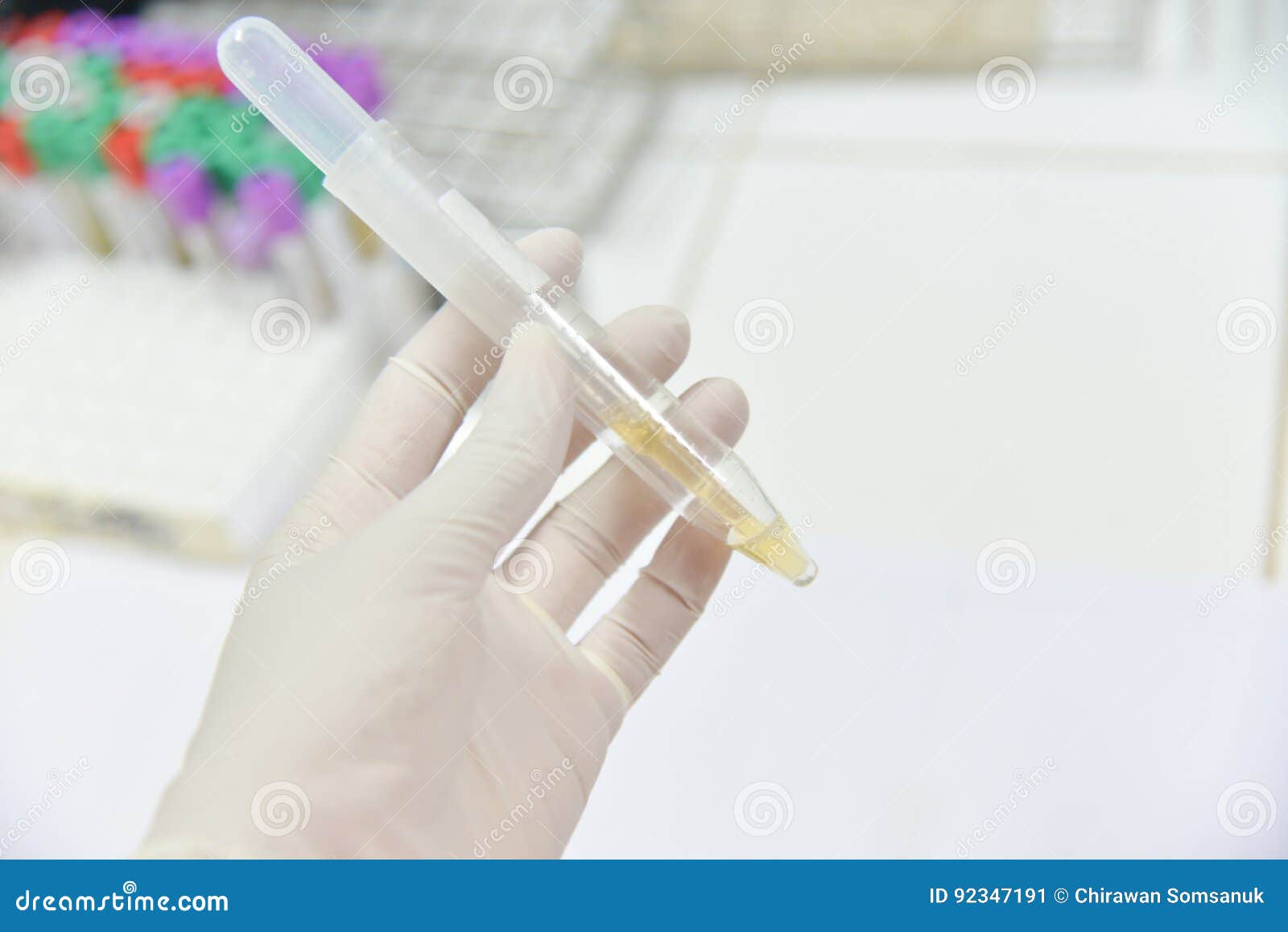 Urine sample in tube stock image. Image of liquid, medical - 92347191