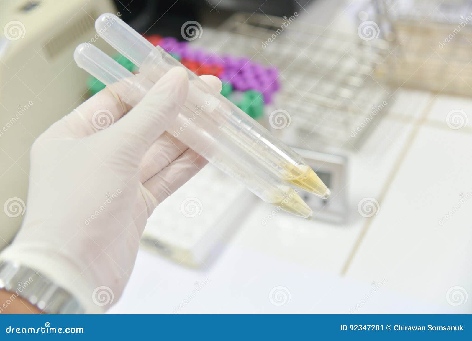 Urine sample in tube stock image. Image of sample, science - 92347201