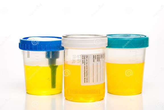 Urine Samples stock image. Image of research, exam, sample - 7591065