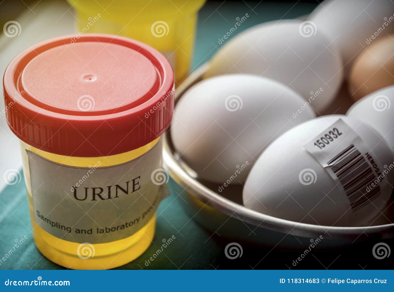 Urine Samples and Eggs in Poor Condition for Examination in Clinical ...