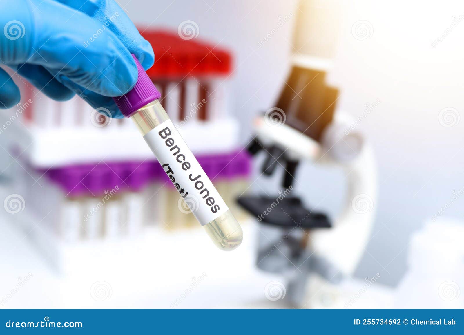 Urine Samples for Testing Bence Jones in the Laboratory Stock Photo ...