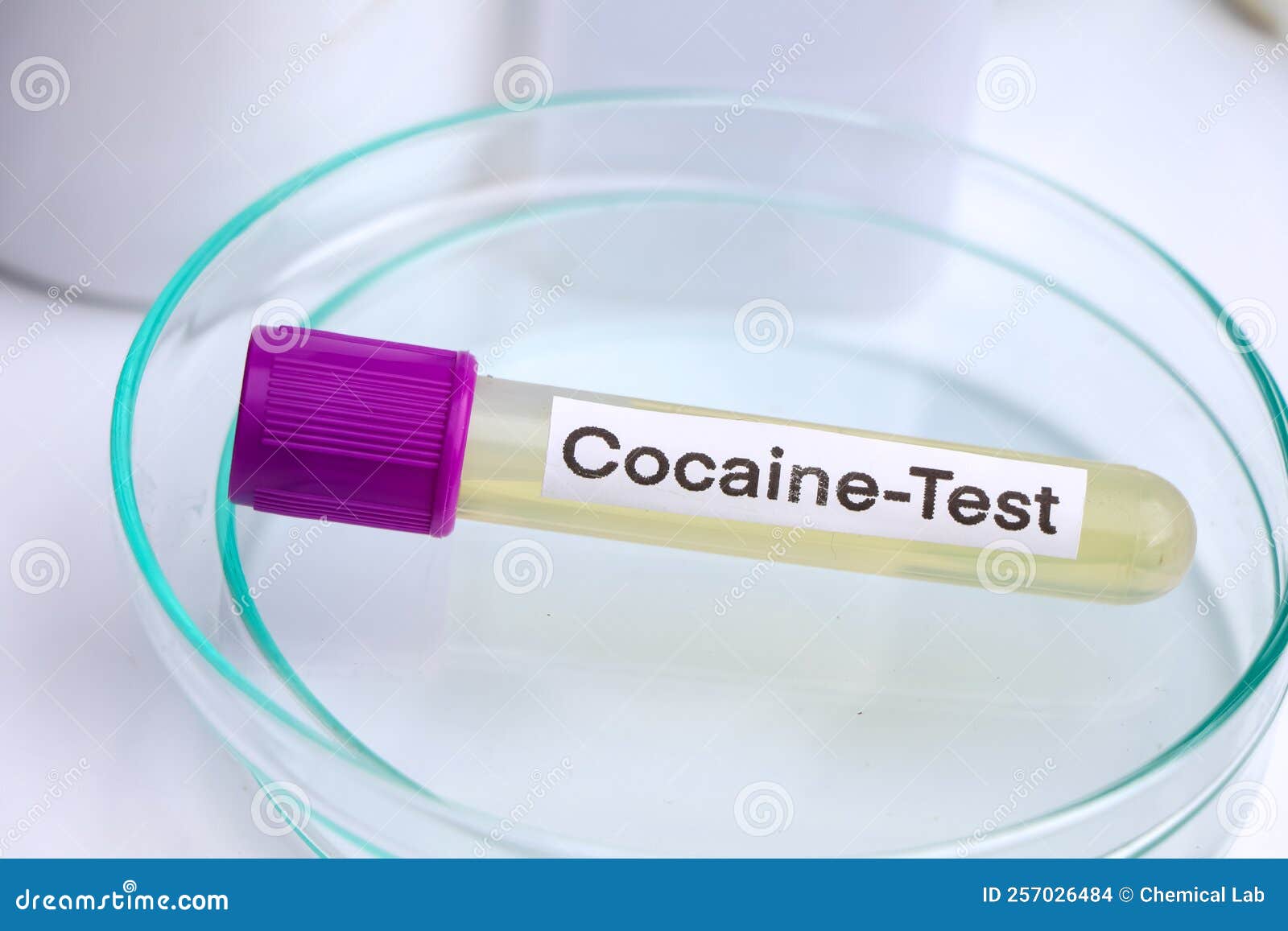 Urine Samples for Testing Cocaine in the Laboratory Stock Photo - Image ...