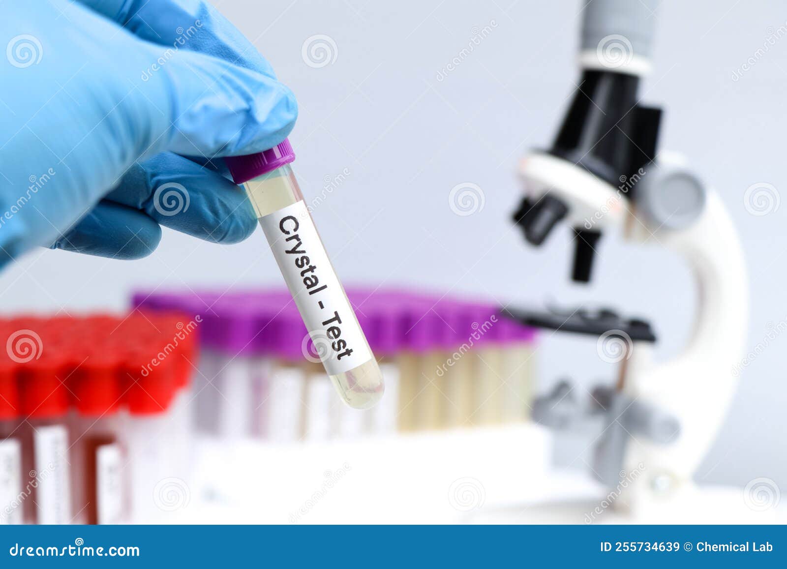 Urine Samples for Testing Crystal in the Laboratory Stock Image - Image ...