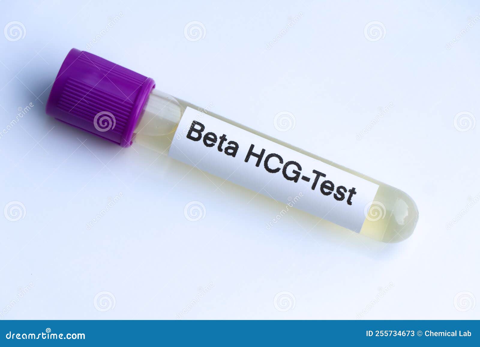 Urine Samples for Testing HCG in the Laboratory Stock Image - Image of ...