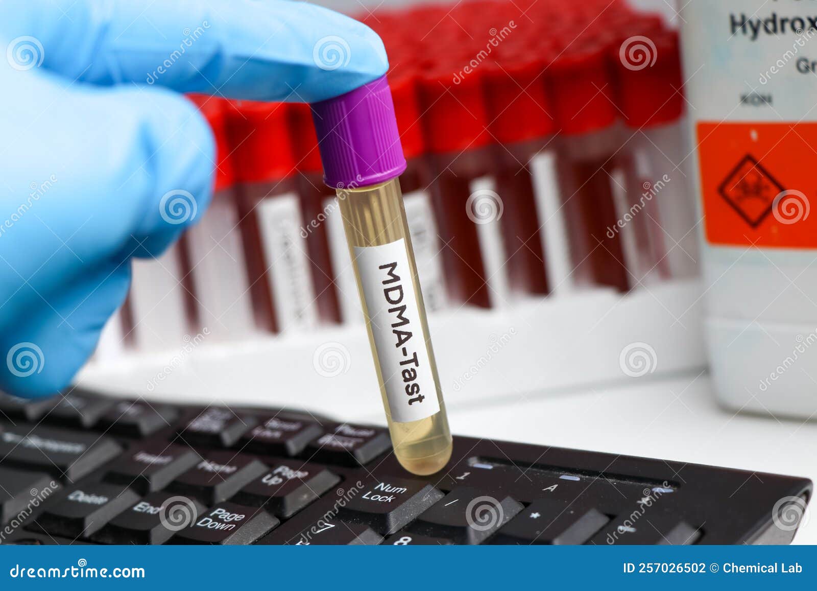 Urine Samples for Testing MDMA in the Laboratory Stock Photo - Image of ...
