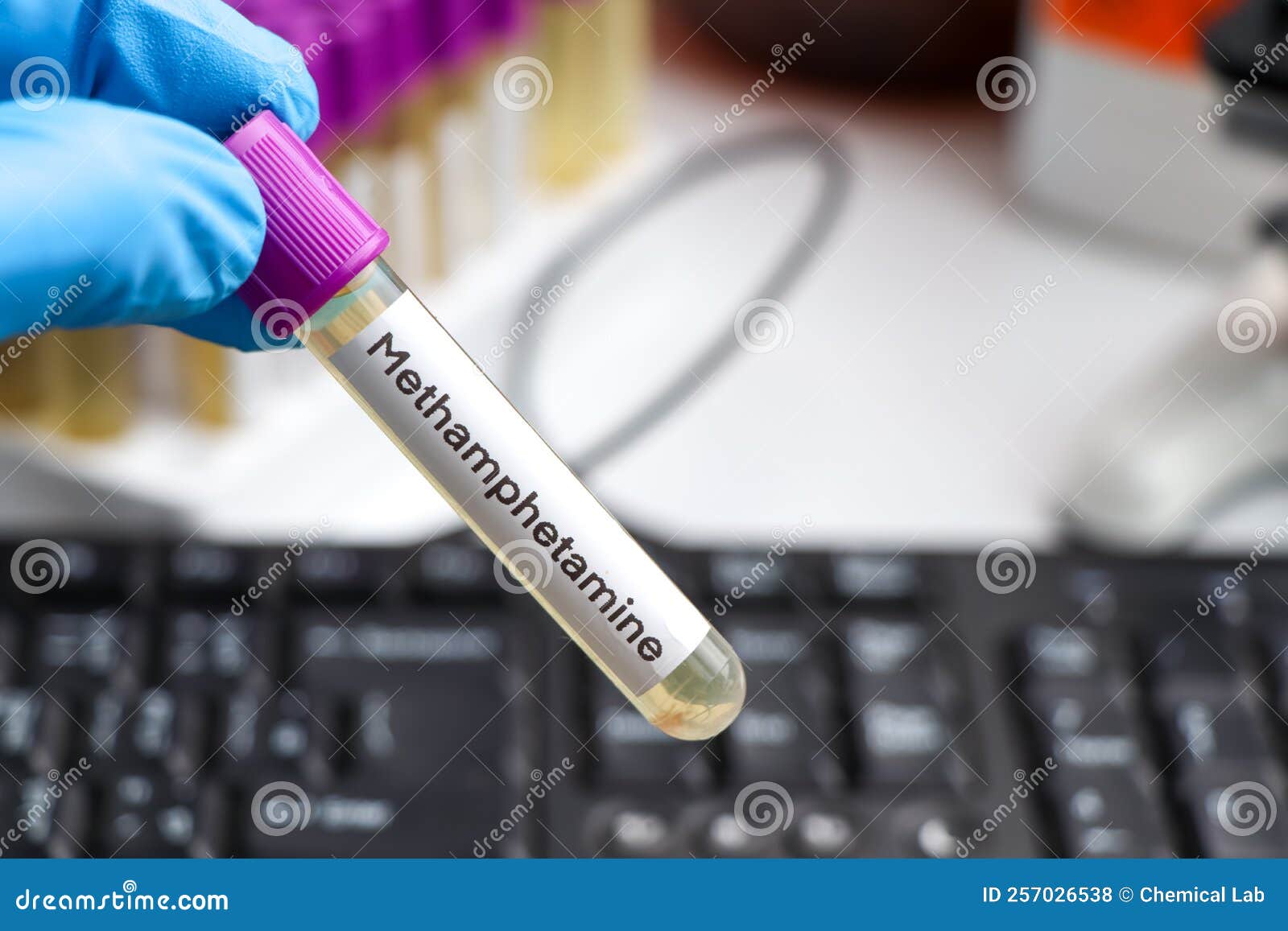 Urine Samples for Testing Methamphetamine in the Laboratory Stock Photo ...