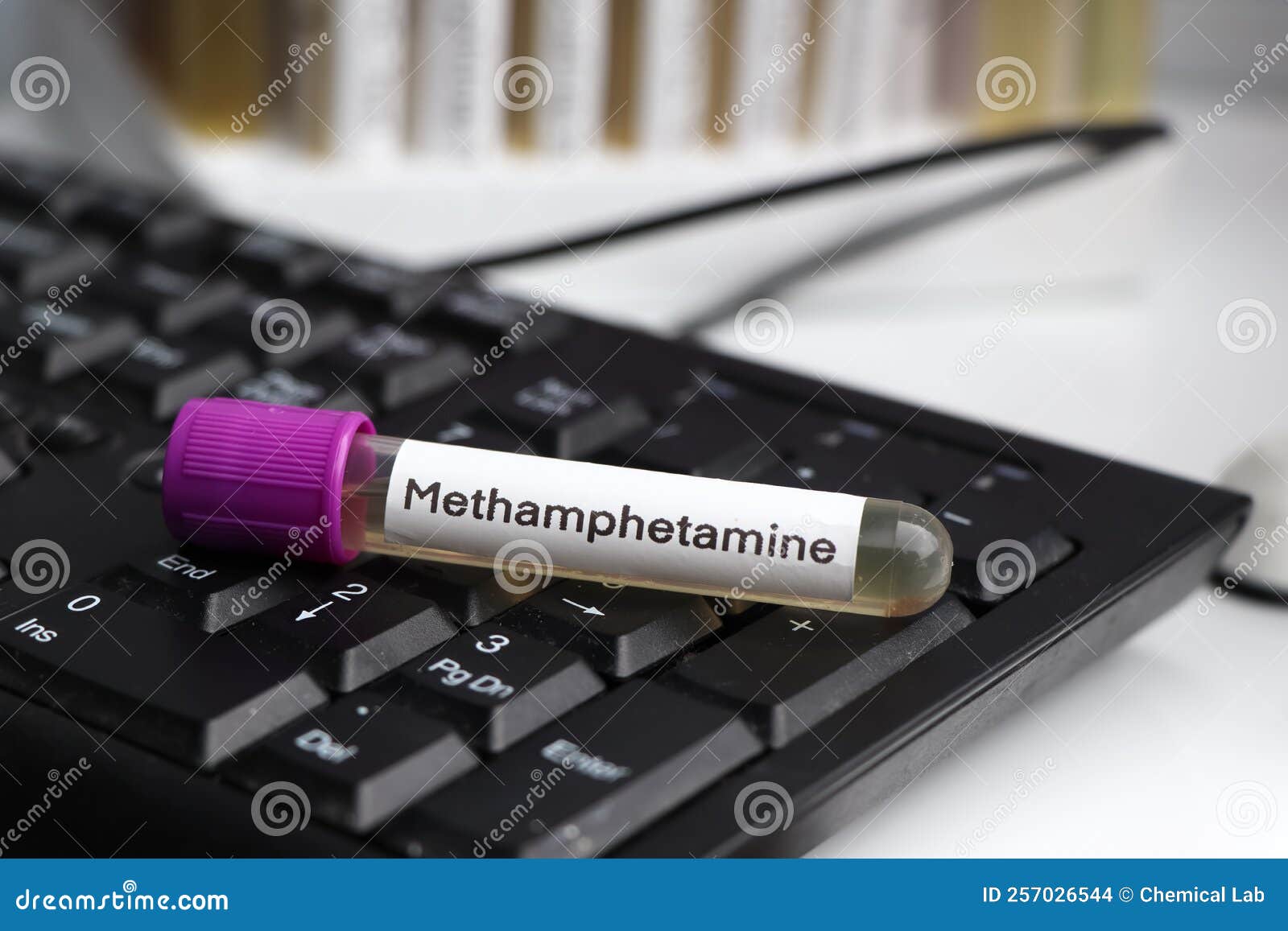 Urine Samples for Testing Methamphetamine in the Laboratory Stock Photo ...