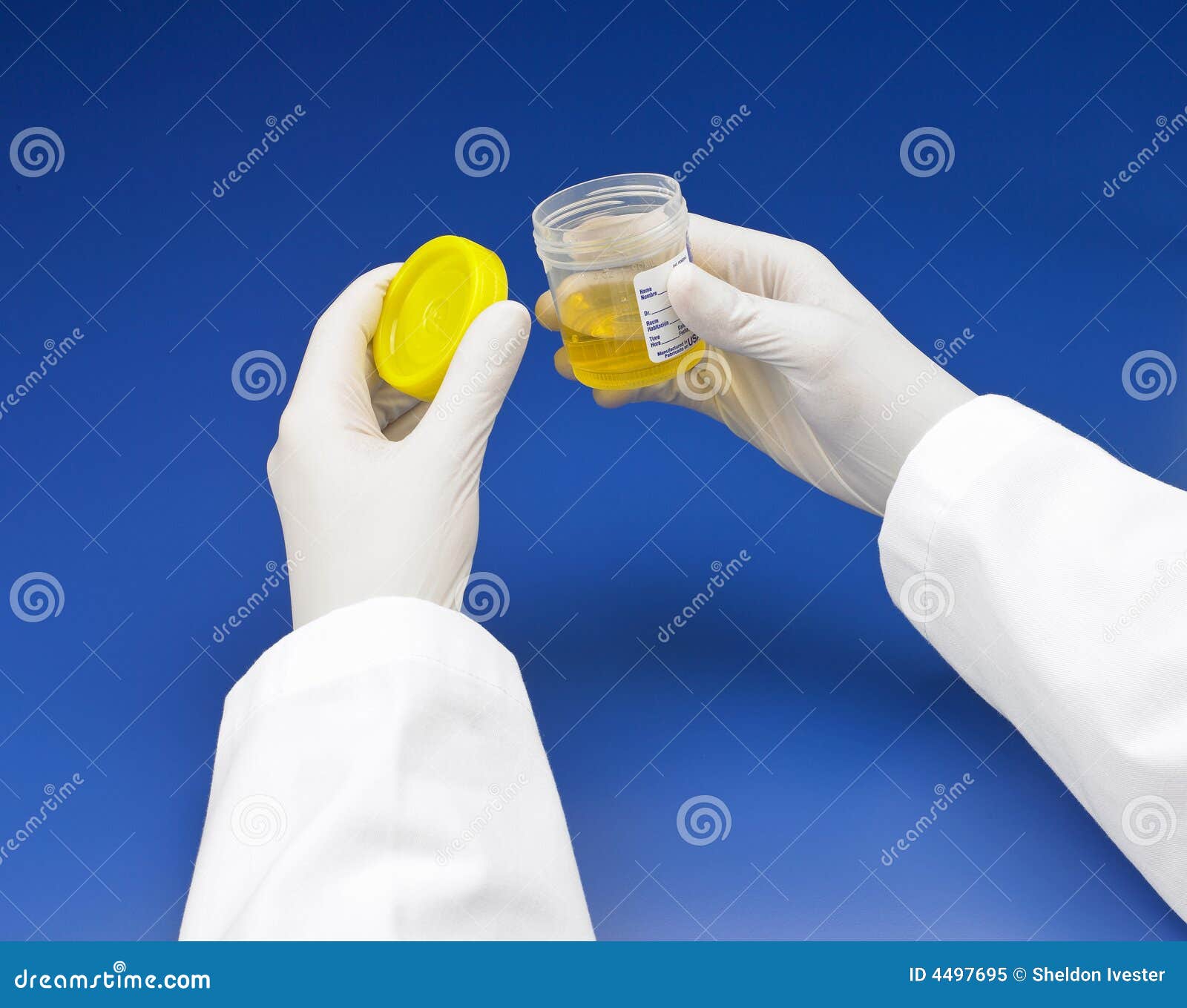Urine Specimen Container Royalty-Free Stock Photography | CartoonDealer ...
