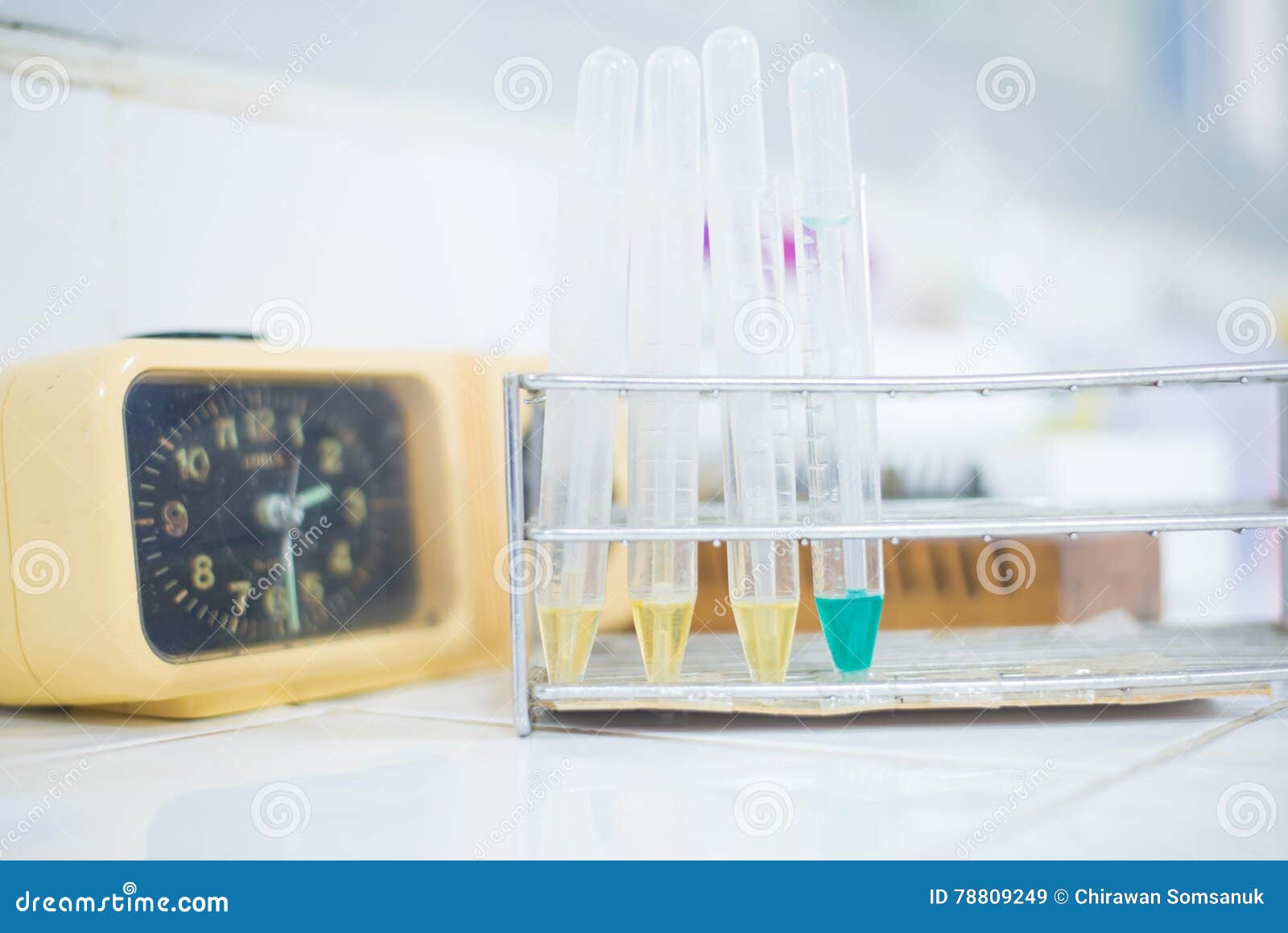 Urine Specimen for Urine Examination Stock Image - Image of hands ...