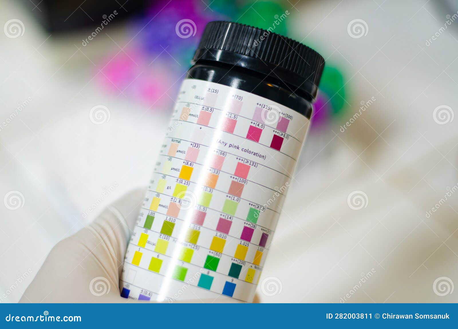 Urine Strip with Scientist in Lab Stock Image - Image of hospital ...