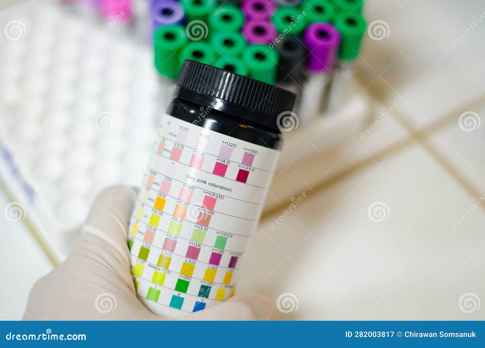 Urine Strip with Scientist in Lab Stock Image - Image of clinical ...