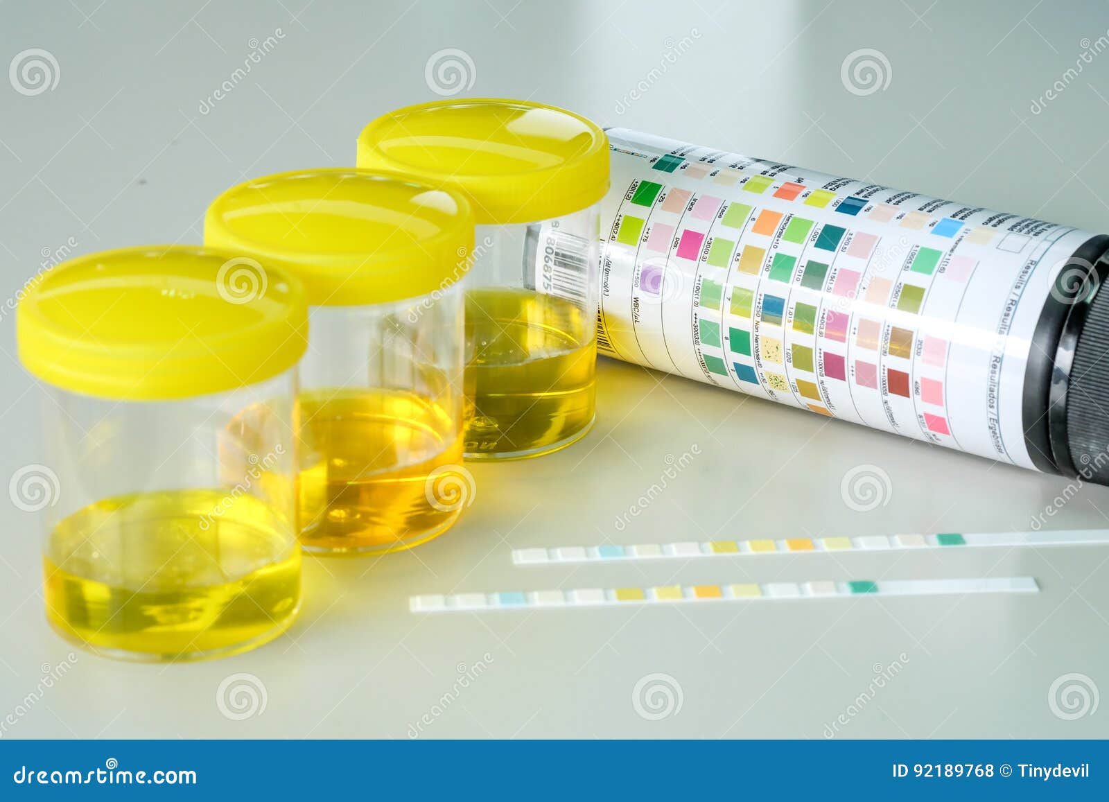 Urine strip test stock photo. Image of diabetic, specimen - 92189768