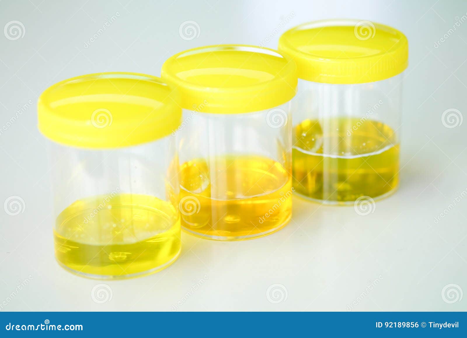 Urine strip test stock photo. Image of urine, strip, science - 92189856
