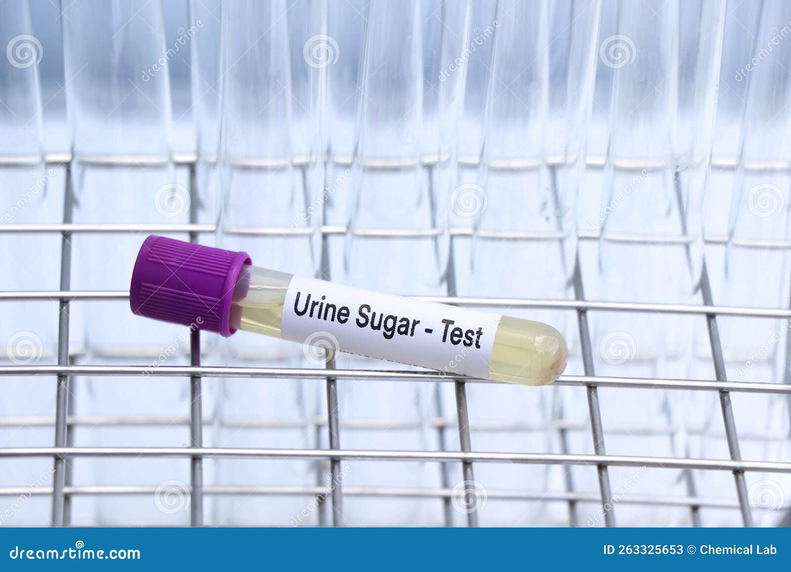 Urine Sugar Test To Look for Abnormalities from Urine, Urine Sample To ...