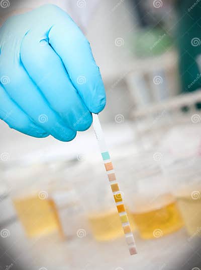 Urine test stock image. Image of researching, urinal - 14016177