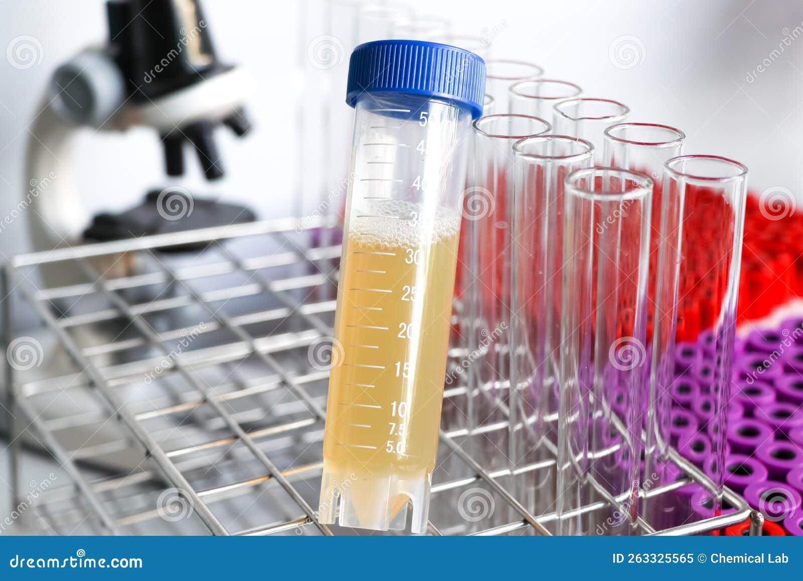 Urine Test To Look for Abnormalities from Urine, Urine Sample To ...