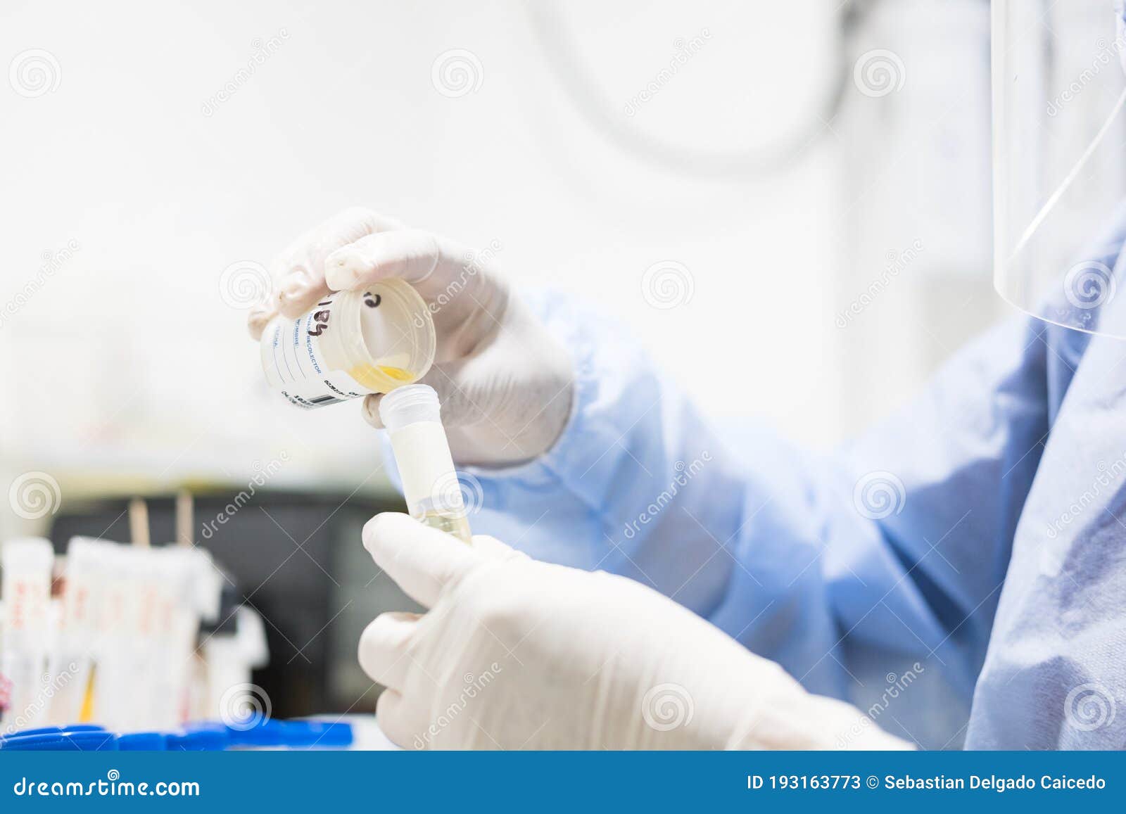 Urine Testing on Laboratory Stock Image - Image of mers, disease: 193163773