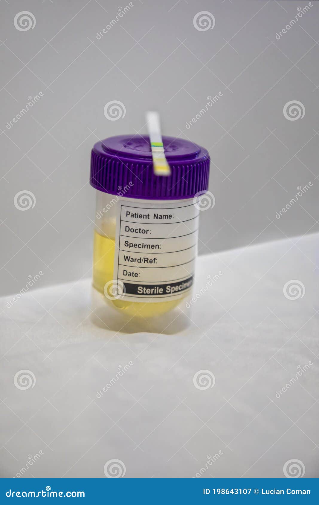 Urine sample stock image. Image of detect, analysis - 198643107
