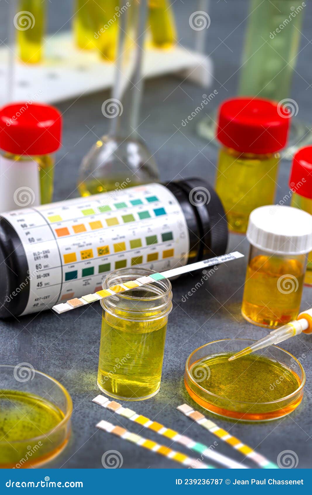 Urine Tests Measurement Close Up View Conceptual Image Stock Image ...