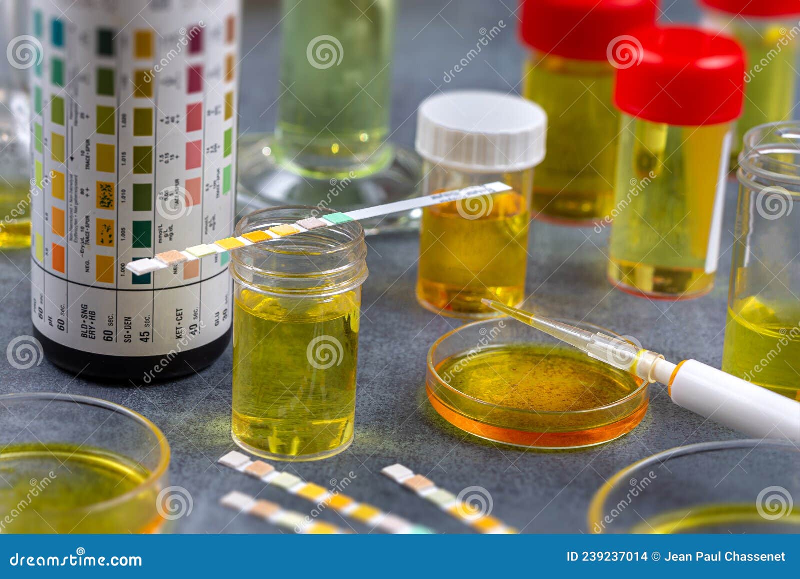 Urine Tests Measurement Close Up View Conceptual Image Stock Photo ...