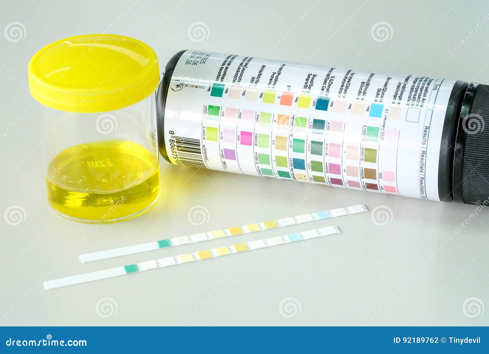 Urinremsaprov arkivfoto. Bild av fysiskt, analys, hälsa - 92189762